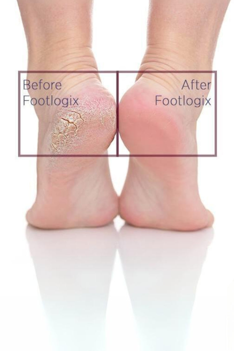 Footlogix Australia